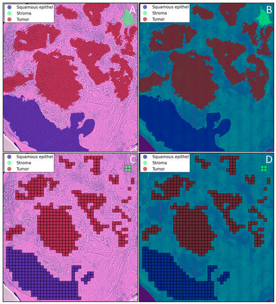 AI-Based Detection of Oral Squamous Cell Carcinoma with Raman Histology