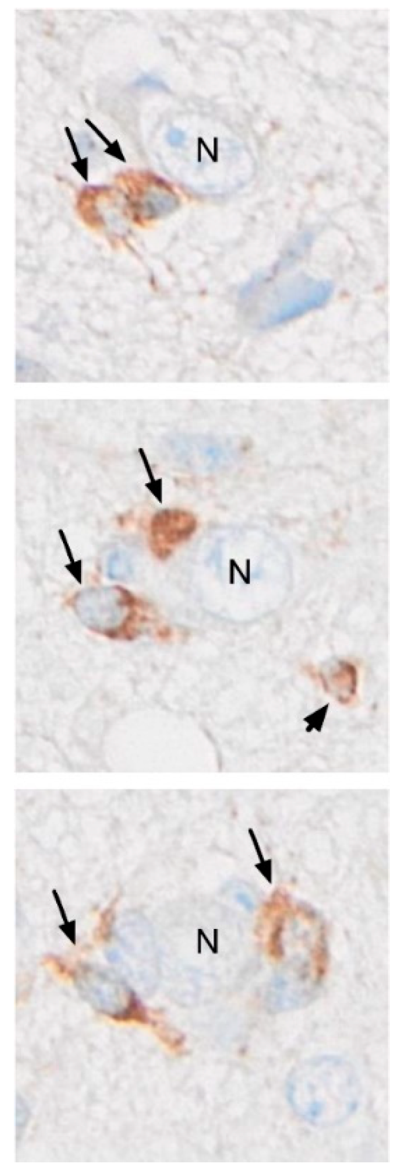 PathoGraph: An Attention-Based Graph Neural Network Capable of Prognostication Based on CD276 ...