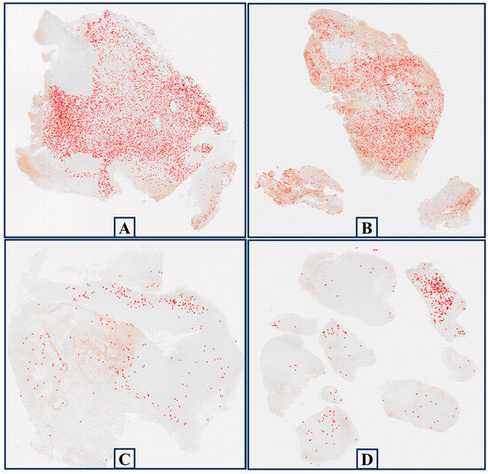 Pathograph An Attention Based Graph Neural Network Capable Of Prognostication Based On Cd276