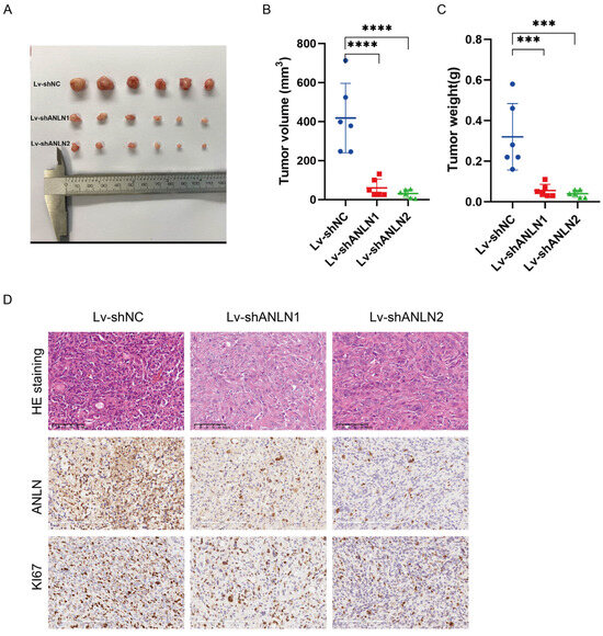 ANLN Promotes the Proliferation and Migration of Gallbladder Cancer ...