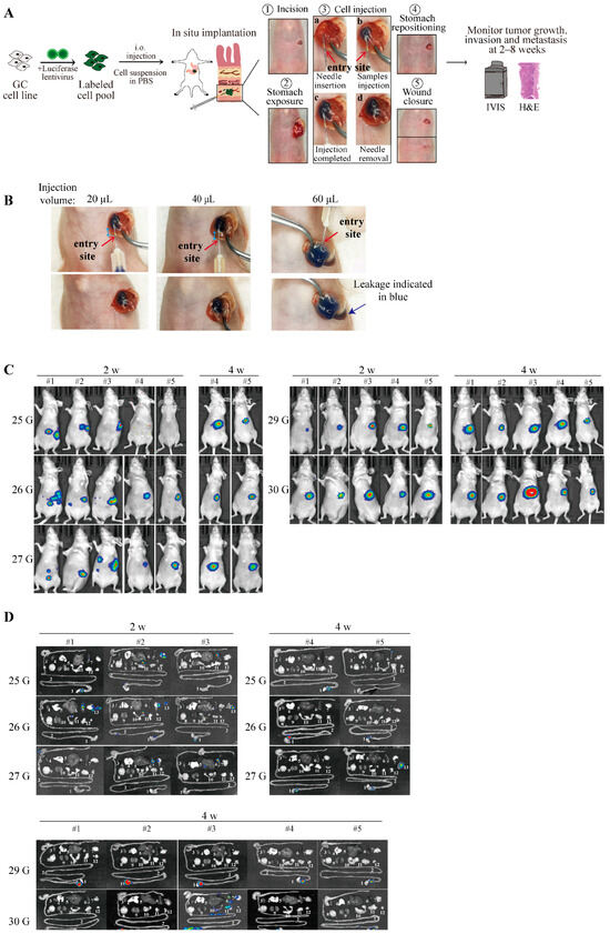 High Engraftment and Metastatic Rates in Orthotopic Xenograft Models of ...