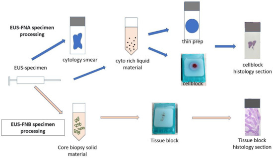 Endoscopic Ultrasound-Guided Fine-Needle Biopsy Versus Aspiration for Tissue Sampling Adequacy ...