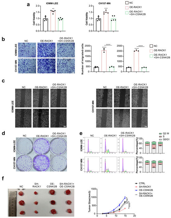 RACK1 Promotes Meningioma Progression by Activation of NF-κB Pathway ...