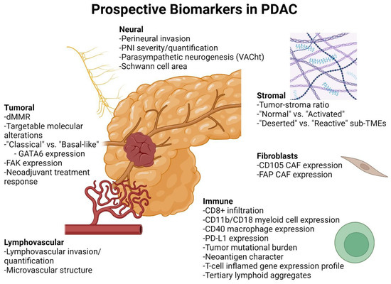 Clinical Evaluation of the Pancreatic Cancer Microenvironment ...