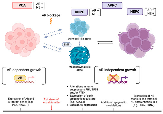 Tissue-Based Diagnostic Biomarkers of Aggressive Variant Prostate ...