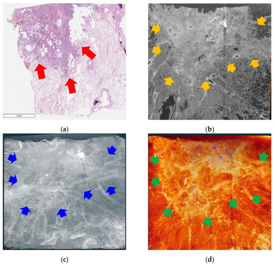 Synchrotron Radiation Refraction-Contrast Computed Tomography Based on ...