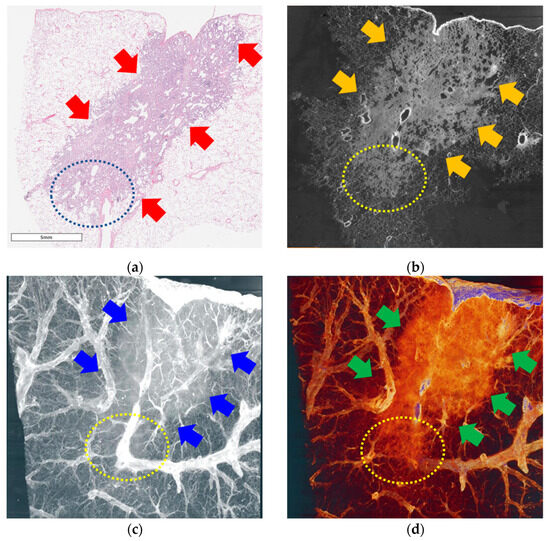 Synchrotron Radiation Refraction-Contrast Computed Tomography Based on ...