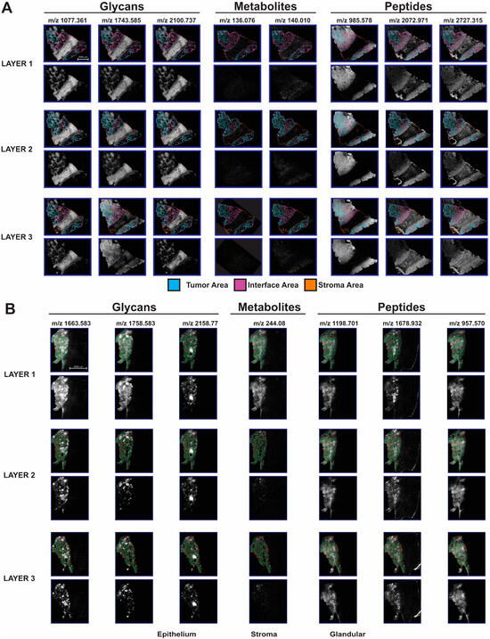 Molecular, Metabolic, and Subcellular Mapping of the Tumor Immune ...