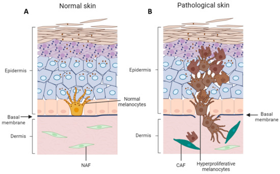 The Keratinocyte in the Picture Cutaneous Melanoma Microenvironment