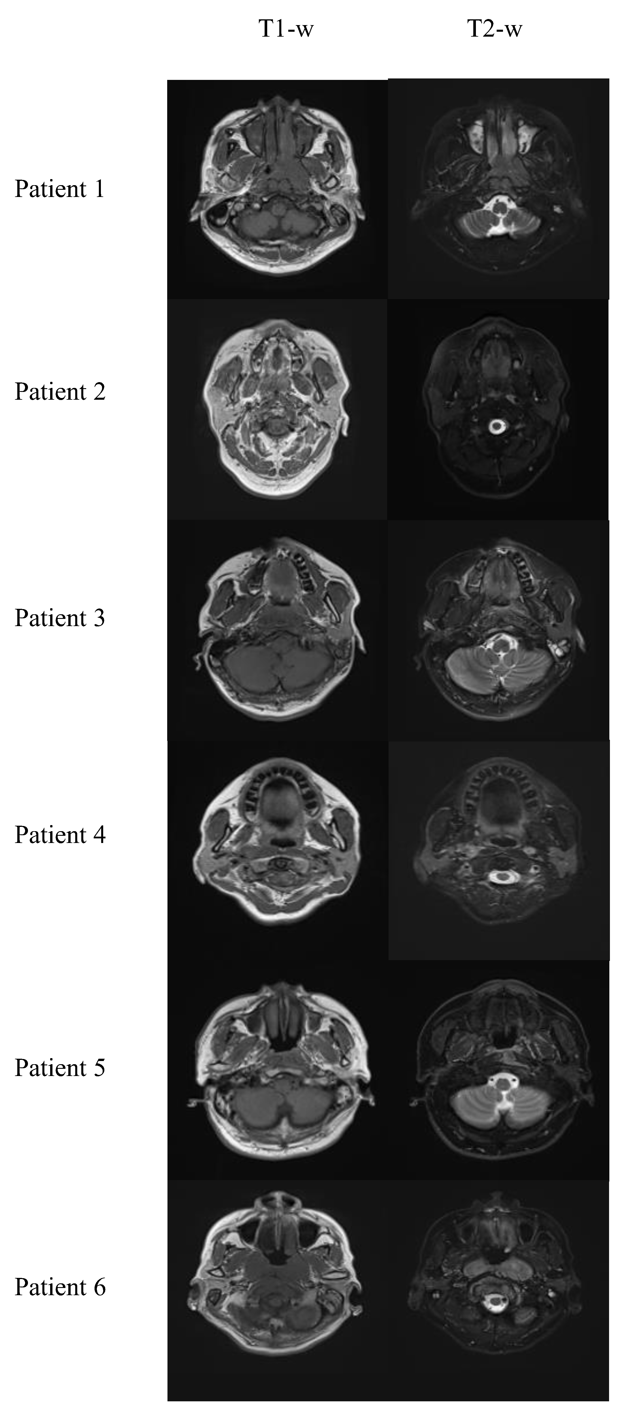 Cancers | Free Full-Text | Pixelwise Gradient Model with GAN for Virtual Contrast Enhancement in ...