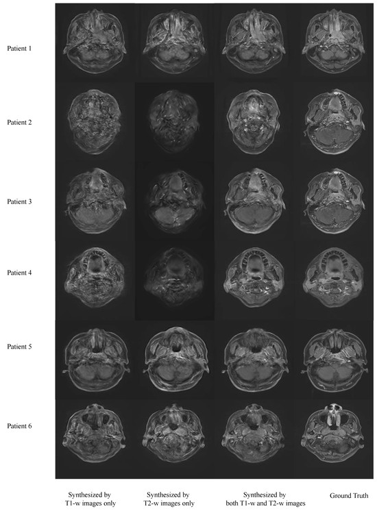 Pixelwise Gradient Model with GAN for Virtual Contrast Enhancement in ...
