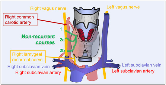 Continuous Intraoperative Nerve Monitoring of a Non-Recurrent Laryngeal ...