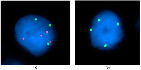 Comparison of Immunotherapy versus Targeted Therapy Effectiveness in ...