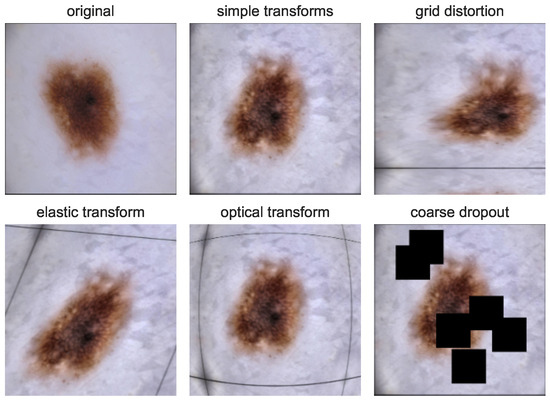 Improving Skin Lesion Segmentation with Self-Training