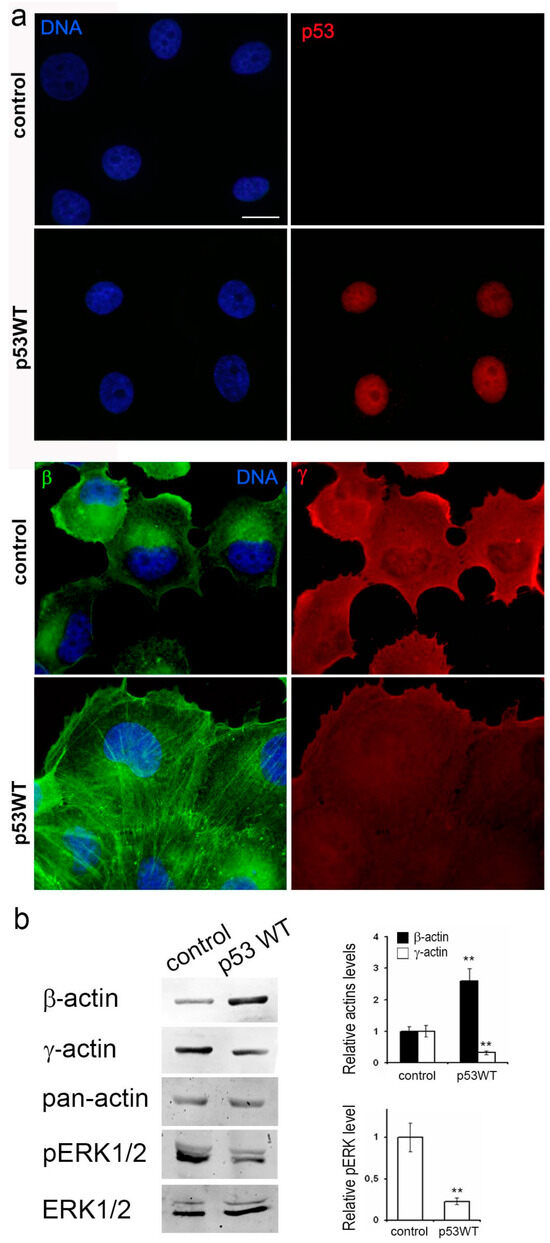 Actin-Dependent Mechanism of Tumor Progression Induced by a Dysfunction ...