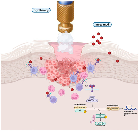 Topical Immunotherapy for Actinic Keratosis and Field Cancerization