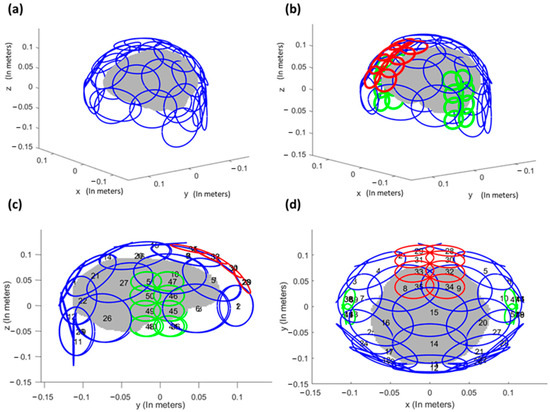 Enhancing Whole-Brain Magnetic Field Homogeneity for 3D-Magnetic ...
