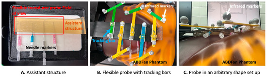 Cancers | Free Full-Text | Enhancing Image-Guided Radiation Therapy for ...