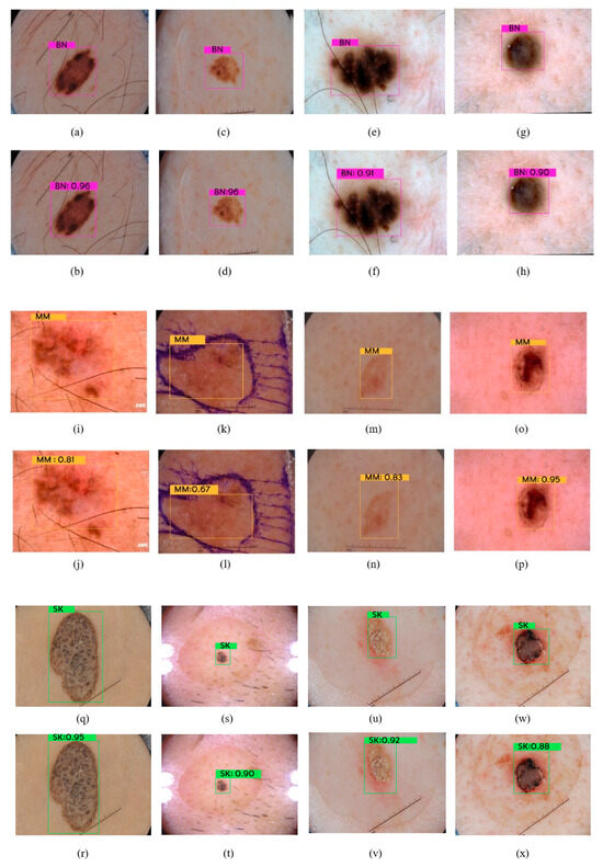 Skin Cancer Recognition Using Unified Deep Convolutional Neural Networks