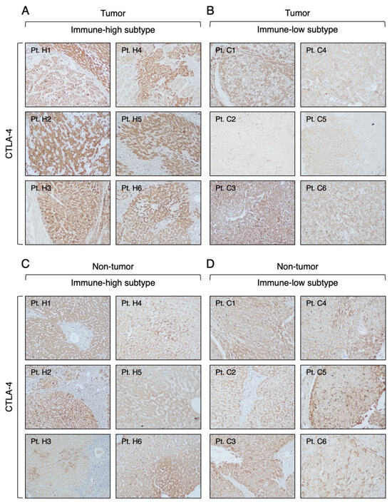 Identification of Two Distinct Immune Subtypes in Hepatitis B Virus ...
