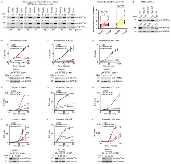 Cancers | Free Full-Text | Lysine Methyltransferase 9 (KMT9) Is an ...
