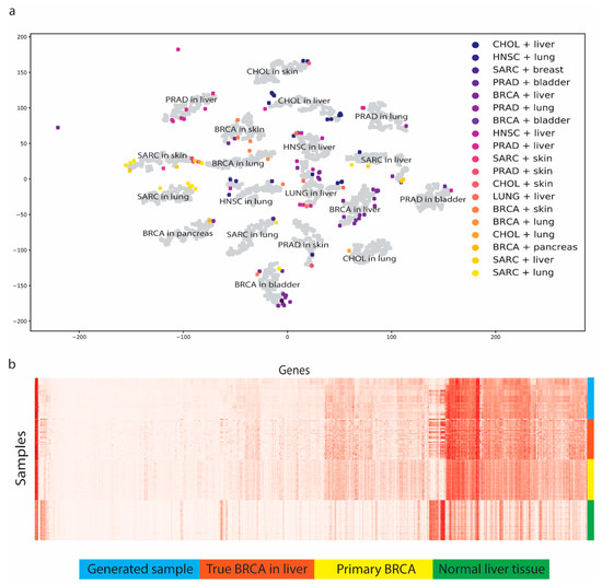 A Metastatic Cancer Expression Generator (MetGen): A Generative ...