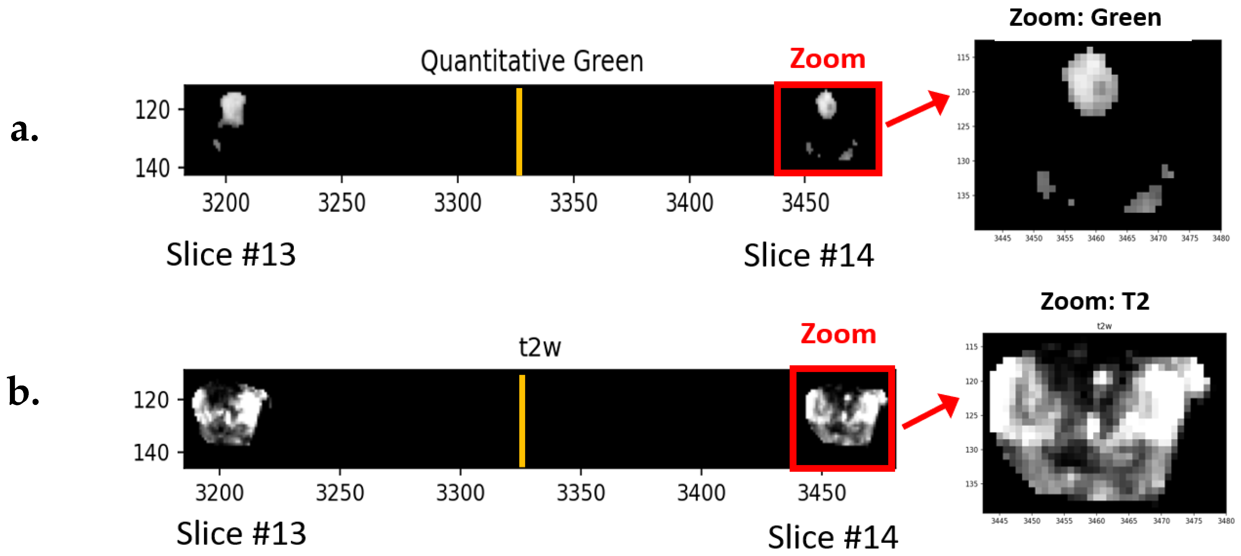 Cancers | Free Full-Text | Autonomous Tumor Signature Extraction Applied to Spatially Registered ...