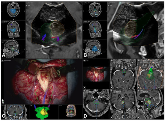 Cancers | Free Full-Text | Enabling Navigation and Augmented Reality in ...