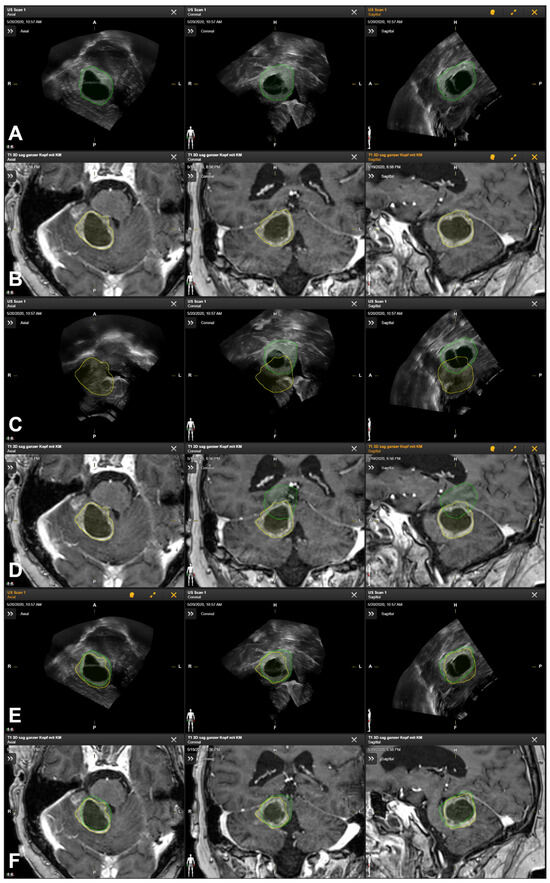 Cancers | Free Full-Text | Enabling Navigation and Augmented Reality in ...