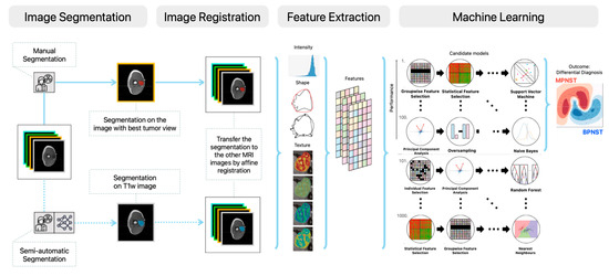 Cancers | Free Full-Text | Preoperative Classification of Peripheral ...