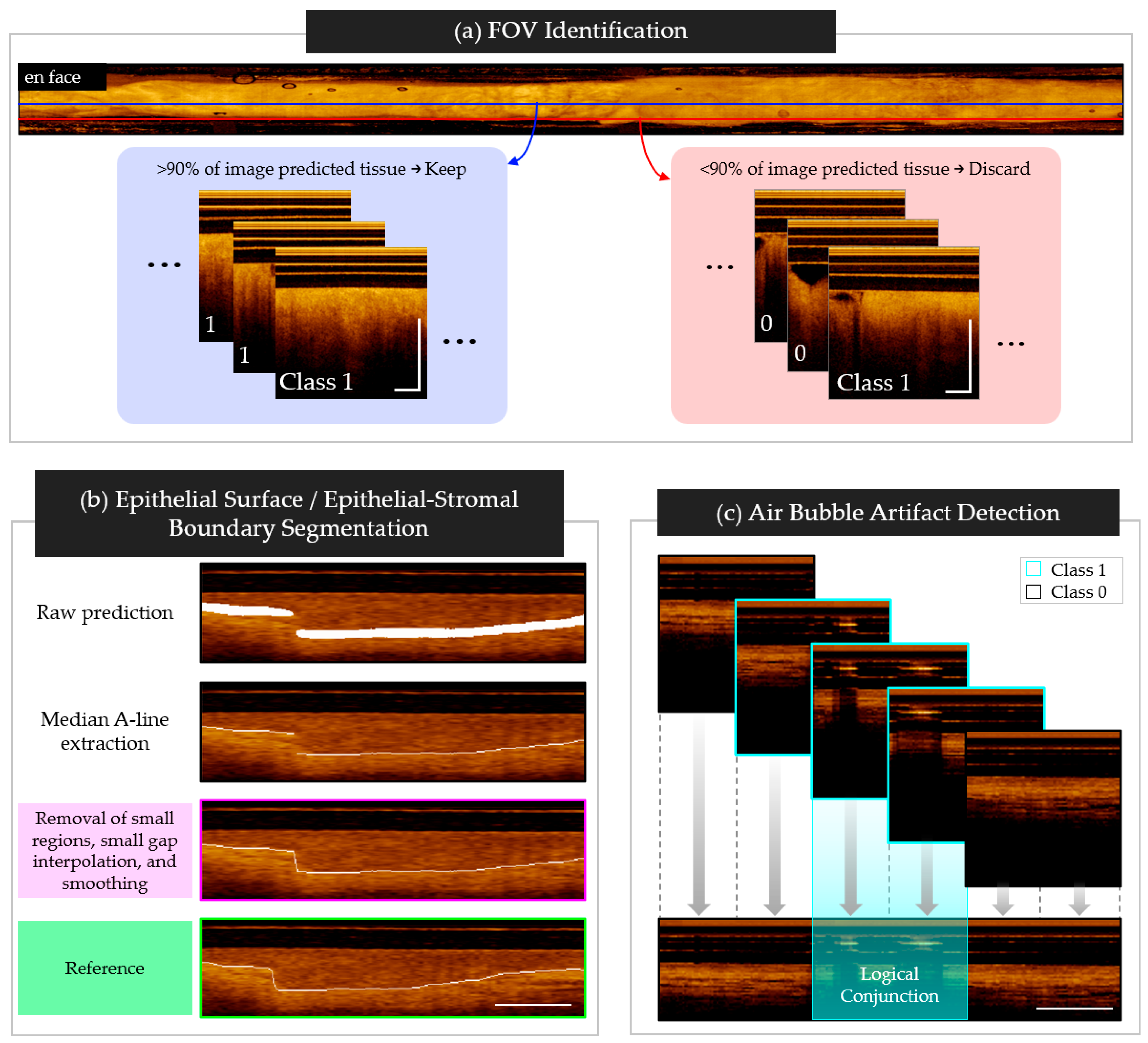 Cancers | Free Full-Text | Three-Dimension Epithelial Segmentation in ...