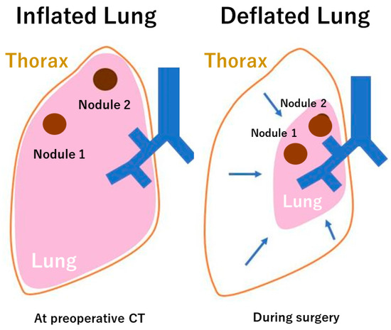Evolution of Three-Dimensional Computed Tomography Imaging in Thoracic ...