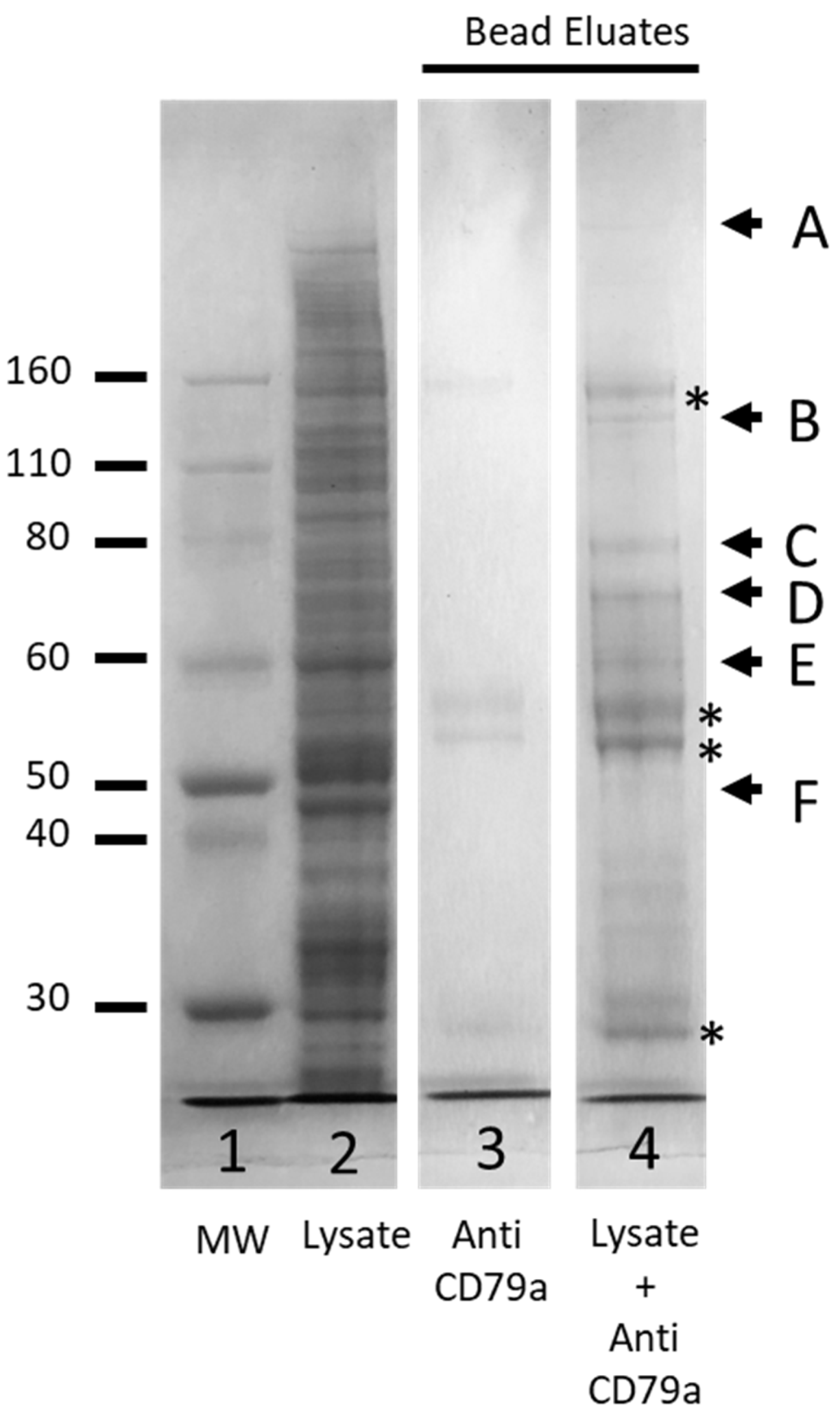 Cancers | Free Full-Text | Method for B Cell Receptor Enrichment in ...