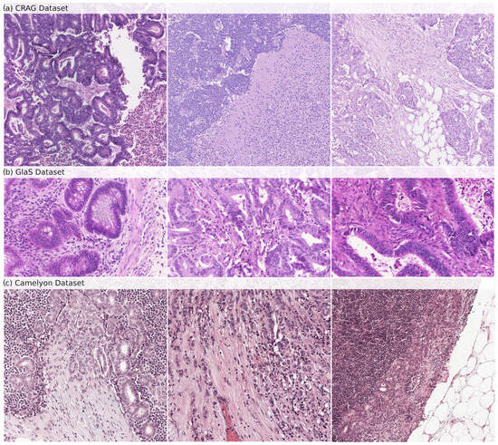 Enhancing Medical Imaging Segmentation with GB-SAM: A Novel Approach to ...