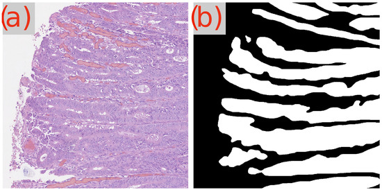 Enhancing Medical Imaging Segmentation with GB-SAM: A Novel Approach to ...