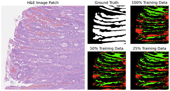 Enhancing Medical Imaging Segmentation with GB-SAM: A Novel Approach to ...