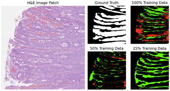 Enhancing Medical Imaging Segmentation with GB-SAM: A Novel Approach to ...