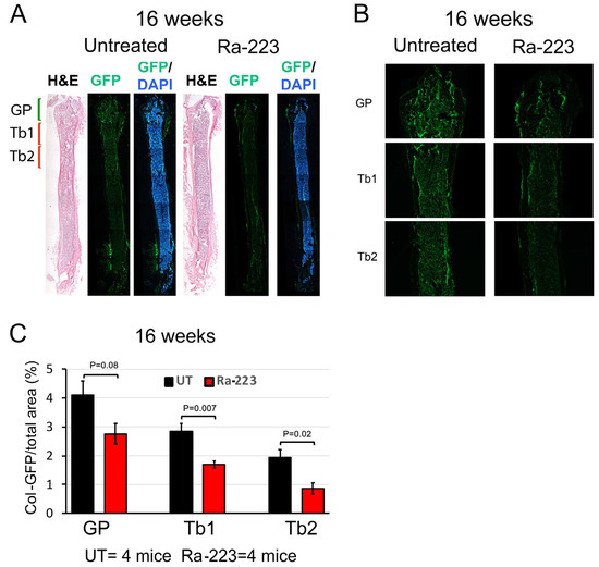 Radium-223 Treatment Produces Prolonged Suppression of Resident ...