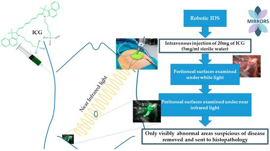 MIRRORS ICG: Perfusion Assessment Using Indocyanine Green (ICG ...