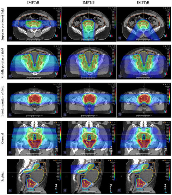 Cancers | Free Full-Text | In Silico Comparison of Three Different Beam ...