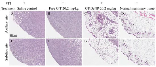 Drug Combination Nanoparticles Containing Gemcitabine and Paclitaxel ...