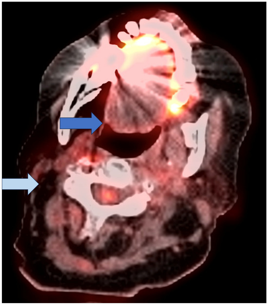 Radiographic Response Assessments and Standardized Imaging ...