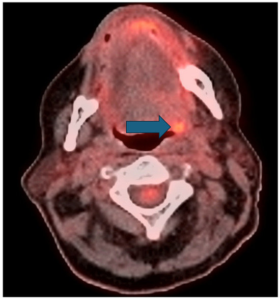 Radiographic Response Assessments and Standardized Imaging ...