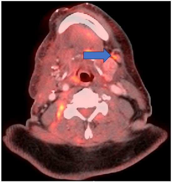 Radiographic Response Assessments and Standardized Imaging ...