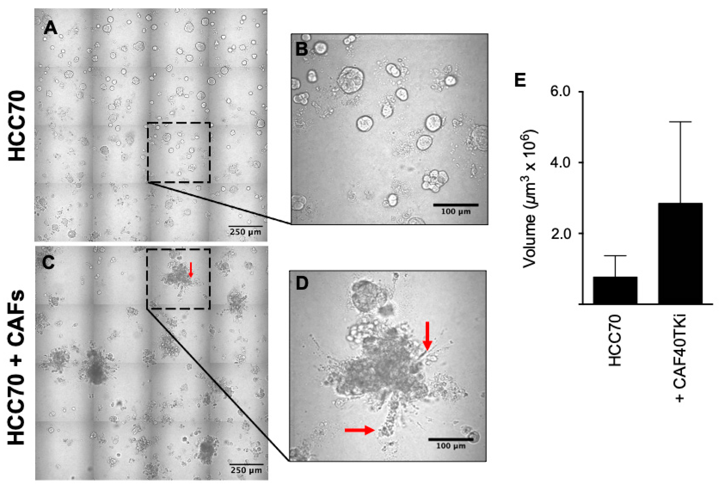 Paracrine Activation of STAT3 Drives GM-CSF Expression in Breast ...