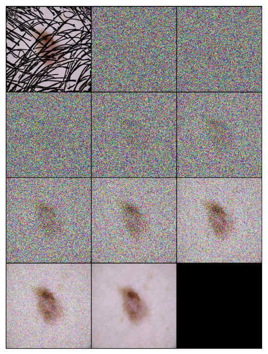 DM–AHR: A Self-Supervised Conditional Diffusion Model for AI-Generated Hairless Imaging for ...