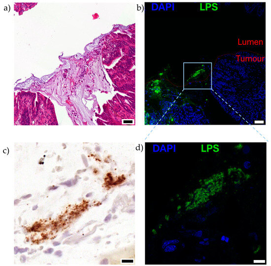 Cancers | Free Full-Text | Towards Understanding Tumour Colonisation by Probiotic Bacterium E ...