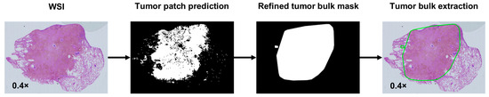 Deep Learning Model for Predicting Lung Adenocarcinoma Recurrence from ...