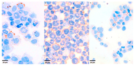 Characterization of Vitronectin Effect in 3D Ewing Sarcoma Models: A ...