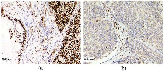 Unraveling the Heterogeneity of Deficiency of Mismatch Repair Proteins ...